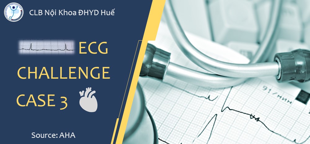 ECG challenge – IMC